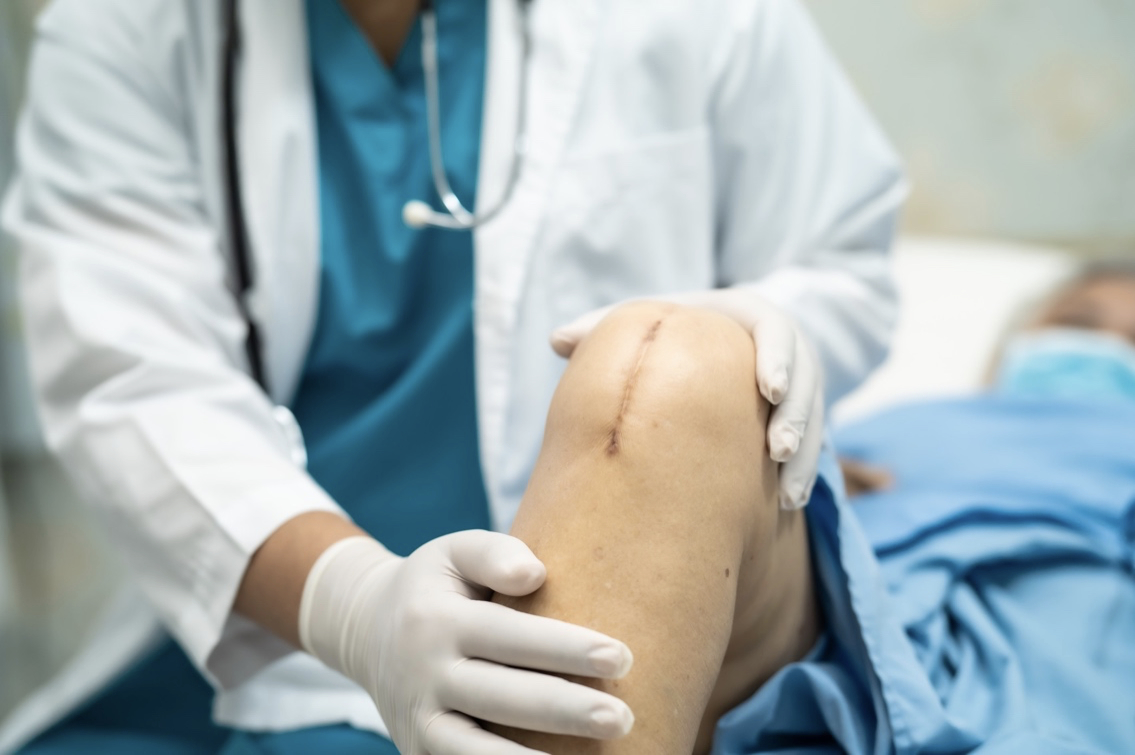 Aftercare Tips for Orthopedic Surgery Scars - Mid-Maryland ...